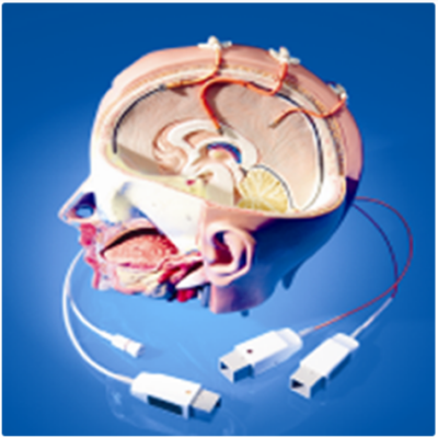 DVE – Derivação Ventricular – Maxi Medica